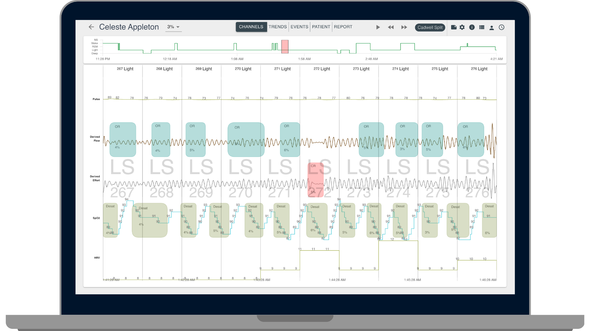 EnsoSleep PPG - EnsoData
