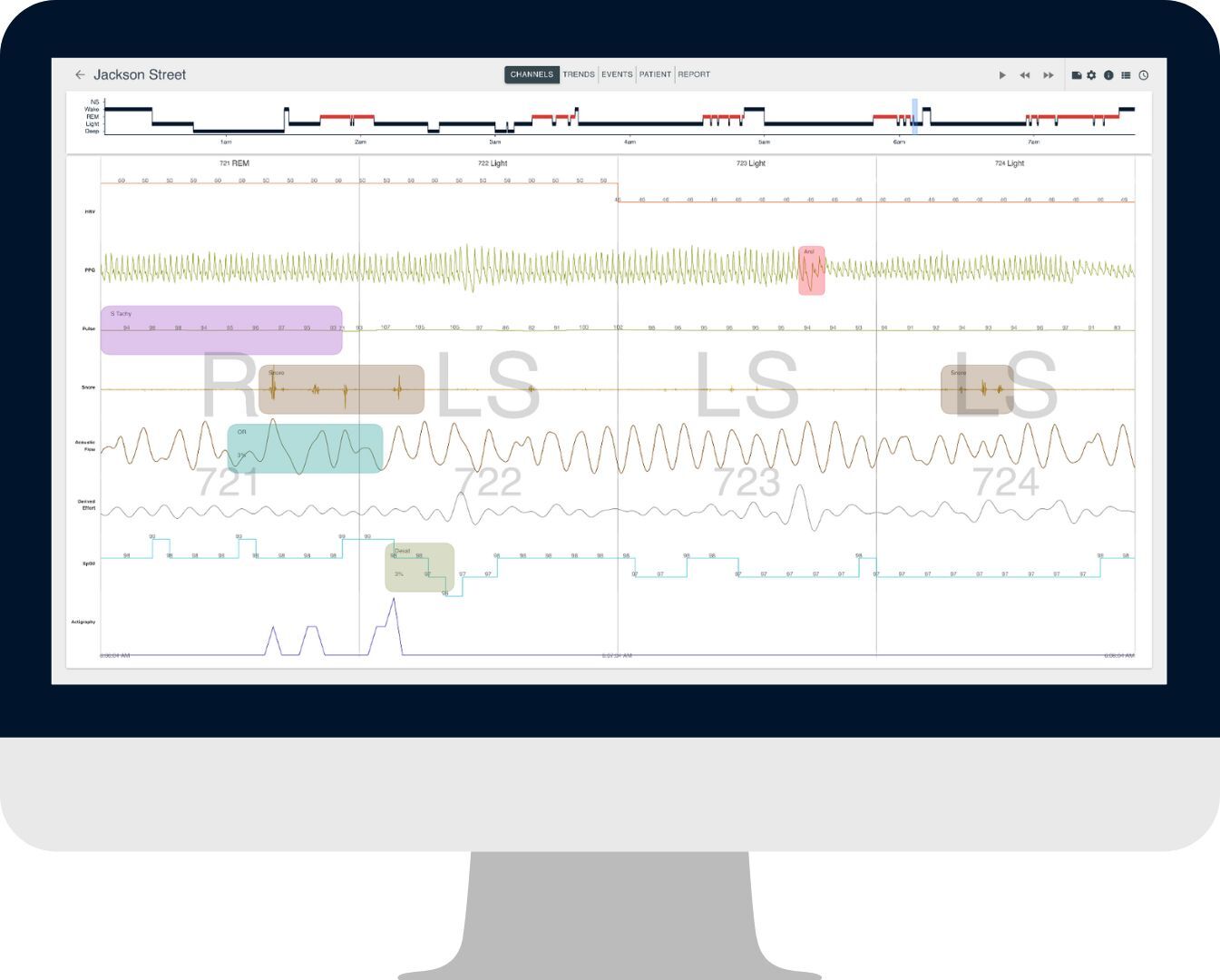 EnsoSleep PPG - EnsoData