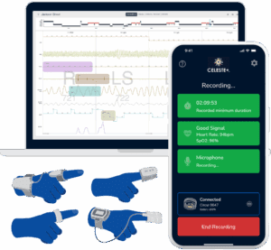 EnsoSleep PPG - EnsoData